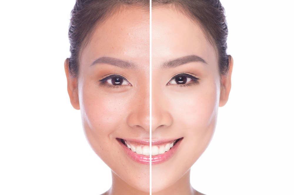 Cerahkan Wajah Kusam Dengan 5 Cara Ini - Beauty Journal