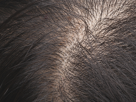 Folikel - Beauty Journal