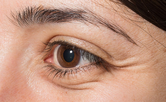 Perkaya Diri dengan 5 Vitamin Ini Untuk Mendapatkan Kulit Sehat ...