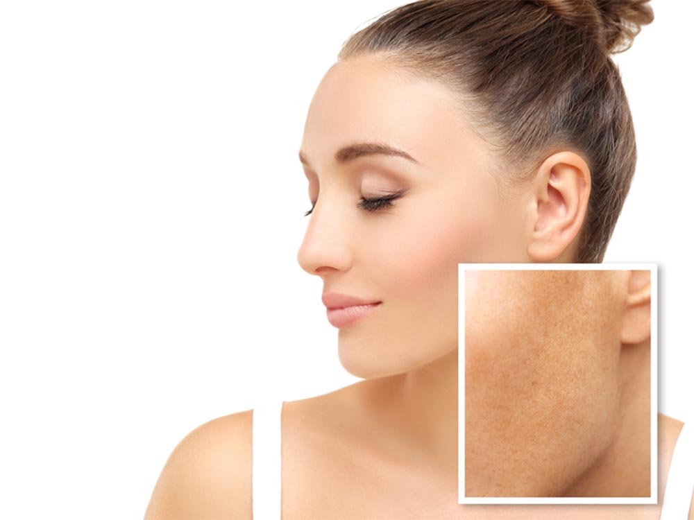 5 Penyebab Pigmentasi Pada Kulit yang Perlu Anda Ketahui - Beauty Journal