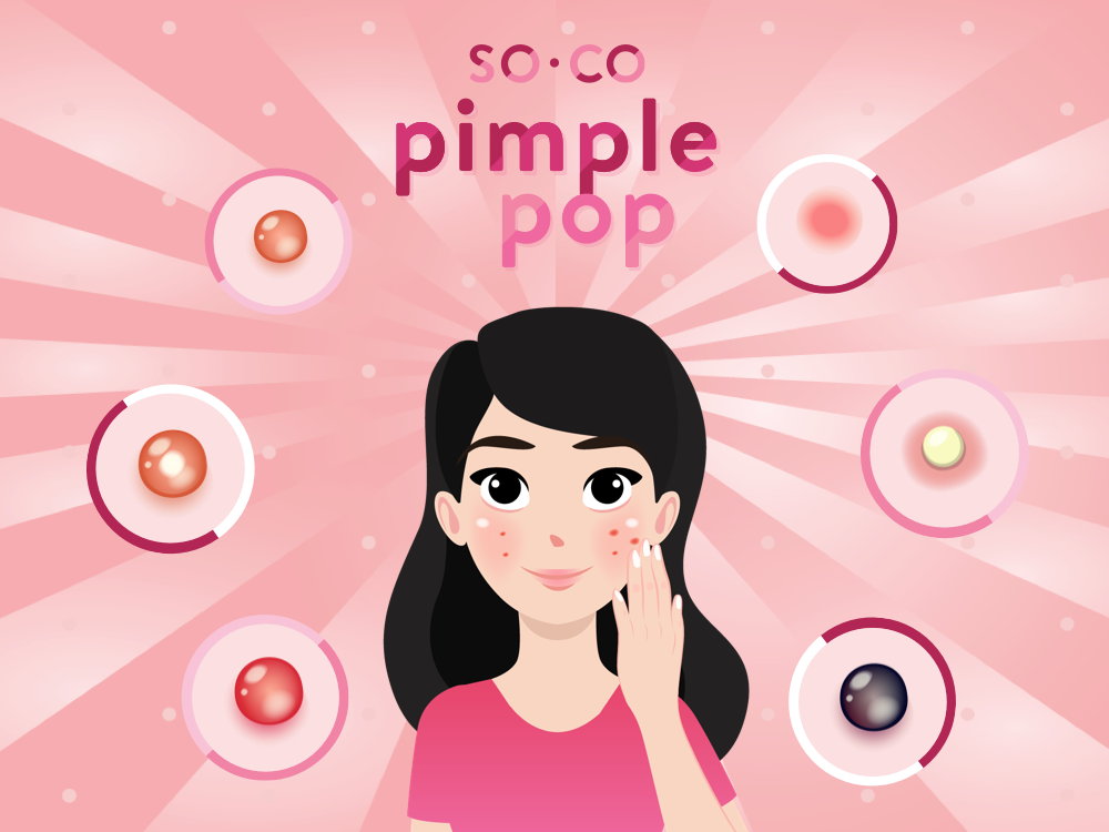 SOCO Pimple Pop: Pencet Jerawat Secepat Mungkin dan Raih Kesempatan ...