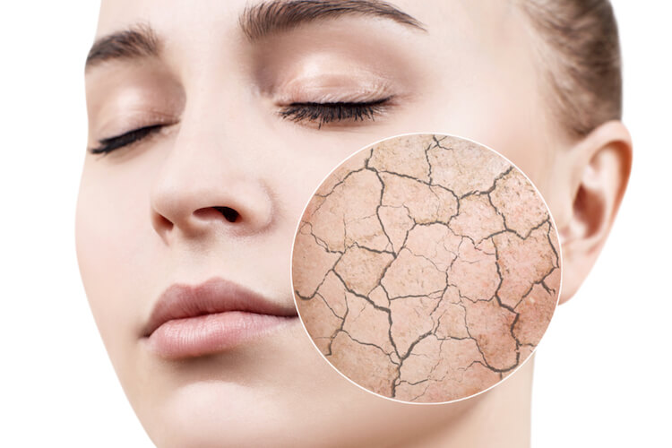 5 Fakta Menarik tentang pH Kulit yang Perlu Diketahui oleh Para Beauty ...