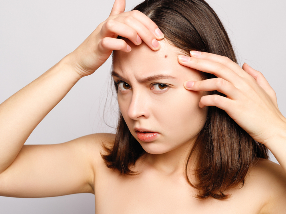 Pilihan Produk Acne Spot Treatment yang Dapat Mengobati Jerawat dengan ...